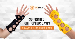 3D Printing Orthopedic Casts - 3D2GO Philippines | 3D Printing Services