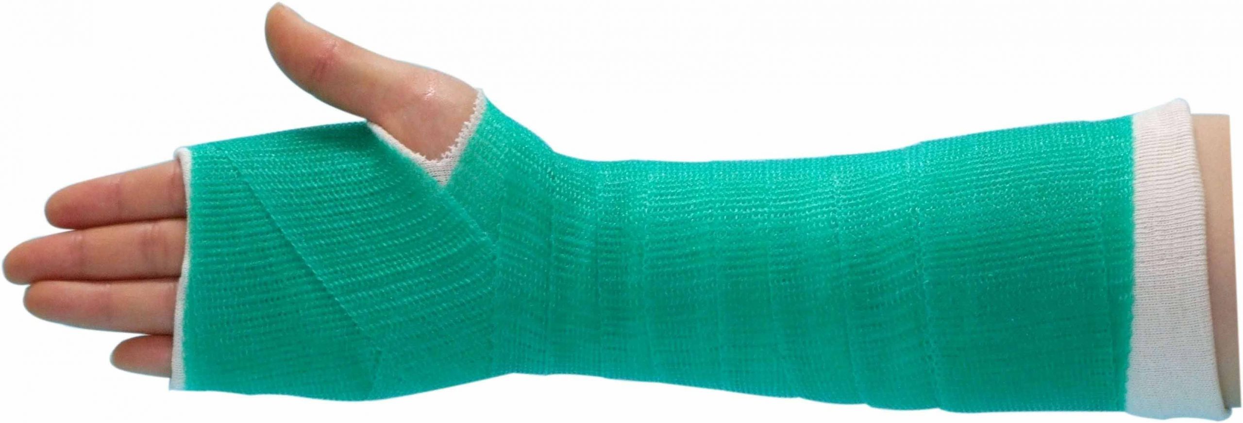 3D Printing Orthopedic Casts 3D2GO Philippines 3D Printing Services