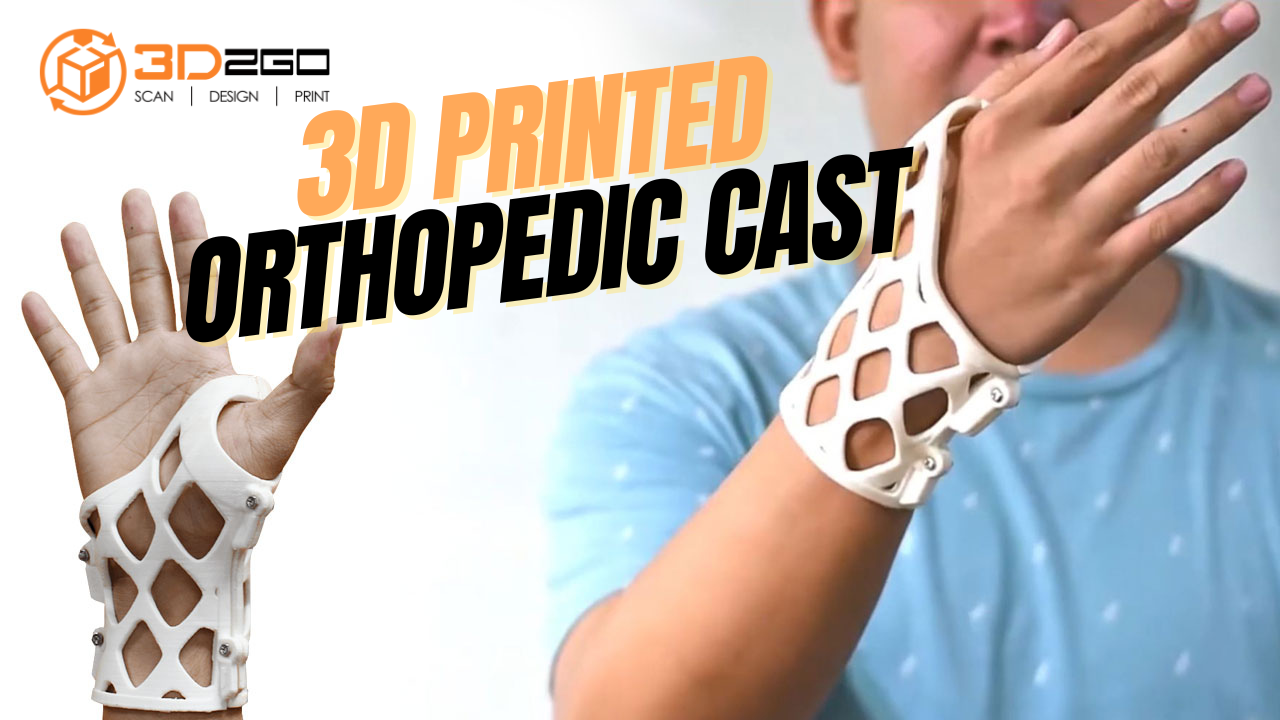 3D Printed Orthopedic Cast - 3D2GO Philippines | 3D Printing Services