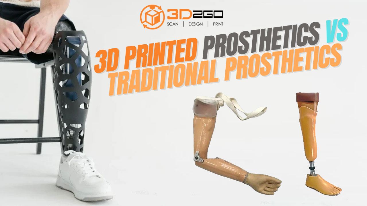 3D Printed Prosthetics VS Traditional Prosthetics - 3D2GO Philippines ...