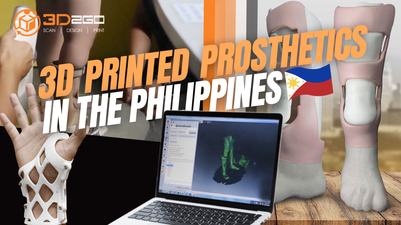 3D Printed Prosthetics in the Philippines - 3D2GO Philippines | 3D Printing Services